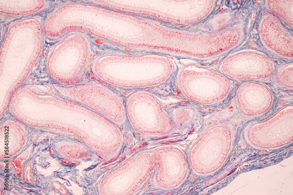 Anatomy and Histological Epididymis and Testis human cells under ...