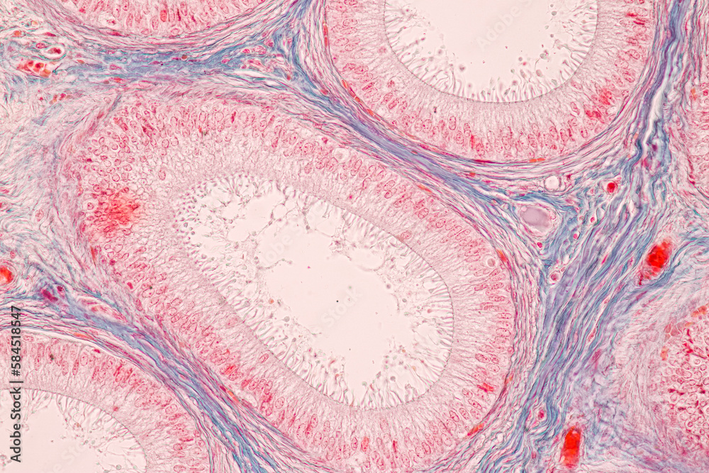 Anatomy and Histological Epididymis and Testis human cells under ...