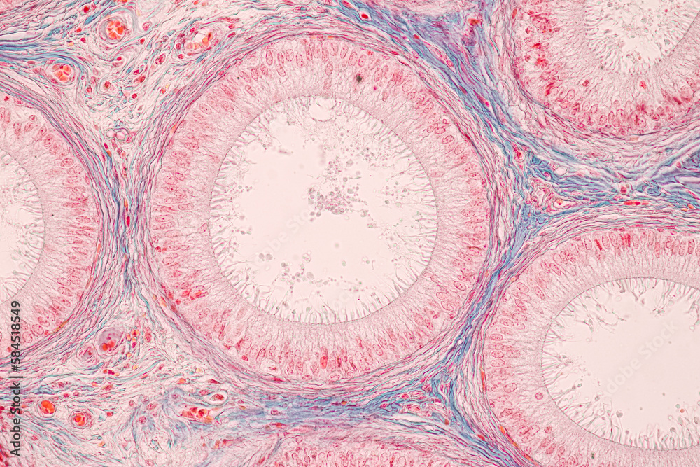 Anatomy and Histological Epididymis and Testis human cells under ...