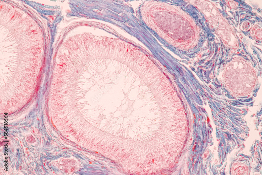 Anatomy and Histological Epididymis and Testis human cells under ...