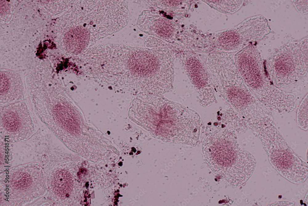 Root tip of Onion and Mitosis cell in the Root tip of Onion under a ...