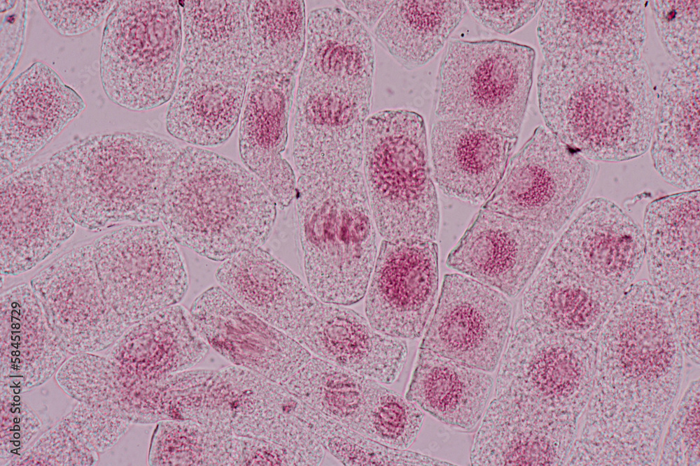 Root tip of Onion and Mitosis cell in the Root tip of Onion under a ...