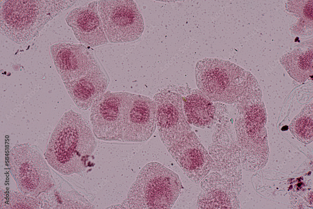 Root tip of Onion and Mitosis cell in the Root tip of Onion under a ...