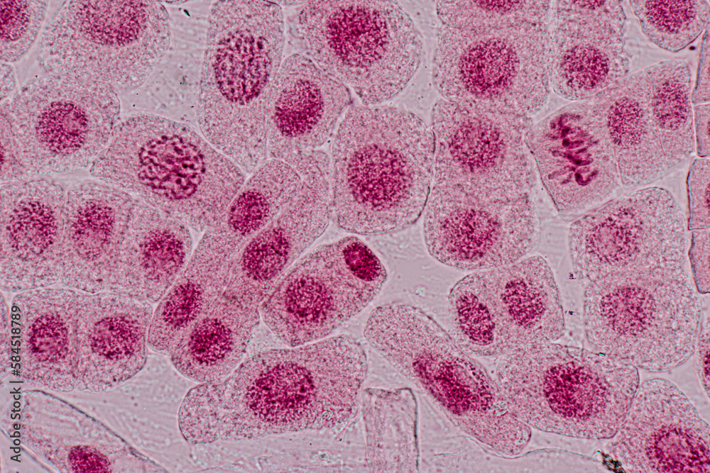Root tip of Onion and Mitosis cell in the Root tip of Onion under a ...