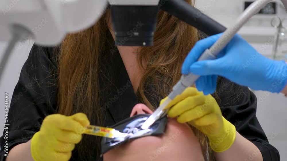 Vidéo Stock Woman dentist works with microscope in mouth of patient's ...