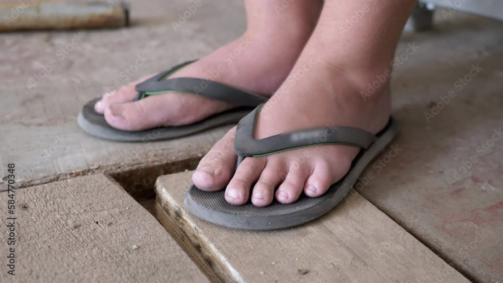 Poor Child Moving Dirty Bare Feet, Wiggling Fingers, Doing Relaxation ...