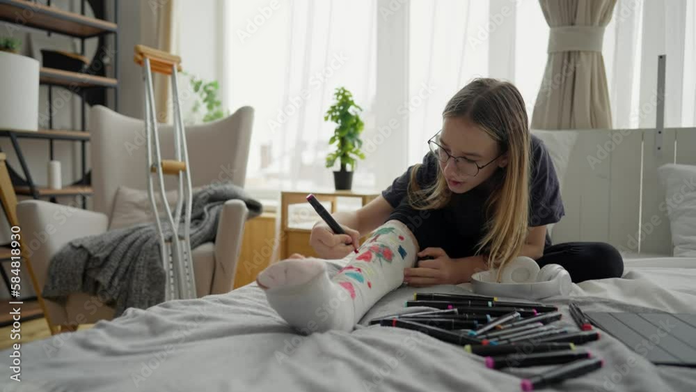 Teenager girl paints on cast leg with felt-tip pens. Young woman draws ...