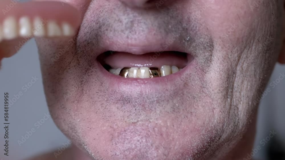 Vídeo do Stock: Smiling Old Elderly Man Takes Out an Upper Denture from ...