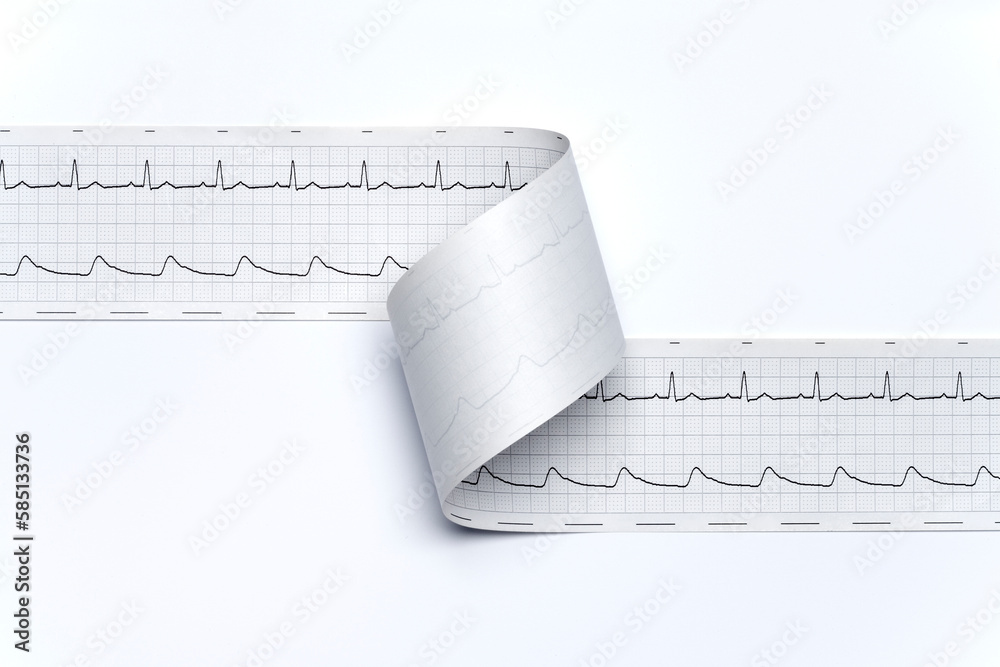 Regular print out elektrocardiogram, ecg, on white background close up ...