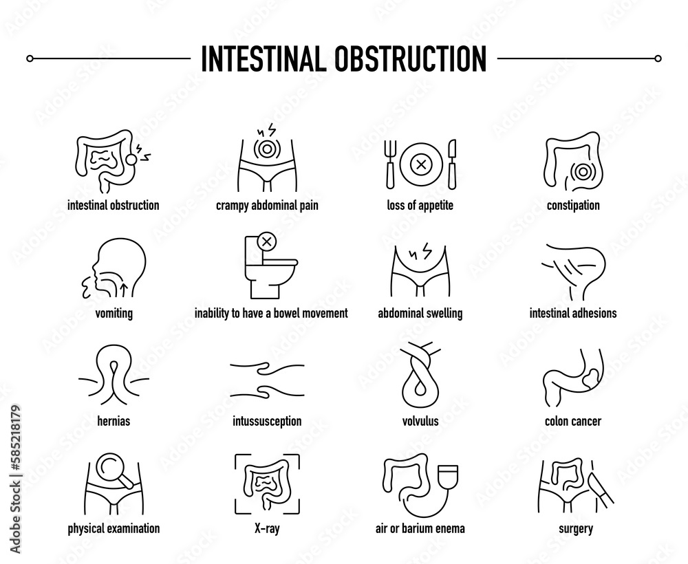Intestinal Obstruction symptoms, diagnostic and treatment vector icon ...