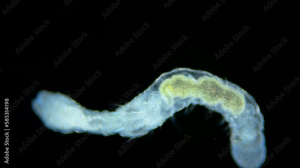 Worm Aeolosoma sp. under a microscope, Aeolosomatidae. They live on ...