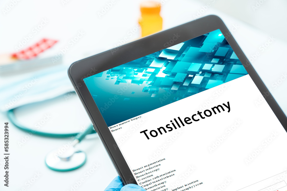 Tonsillectomy Medical Procedures A Surgical Procedure That Involves Removing The Tonsils To