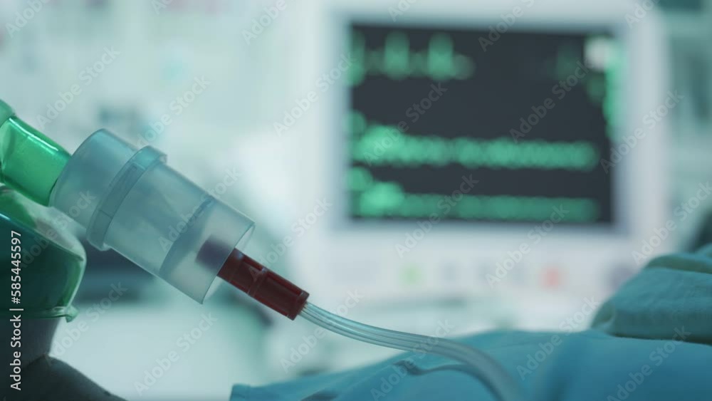 A female patient in medical mask is breathing oxygen support in a ...