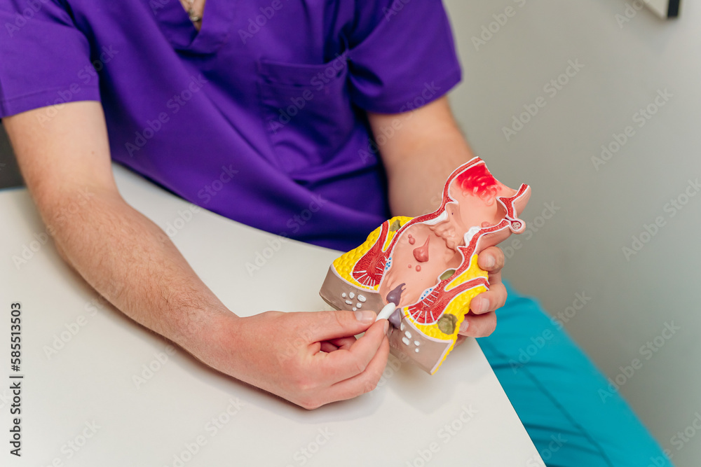 Proctologist doctor inserting rectal suppository into artificial model ...