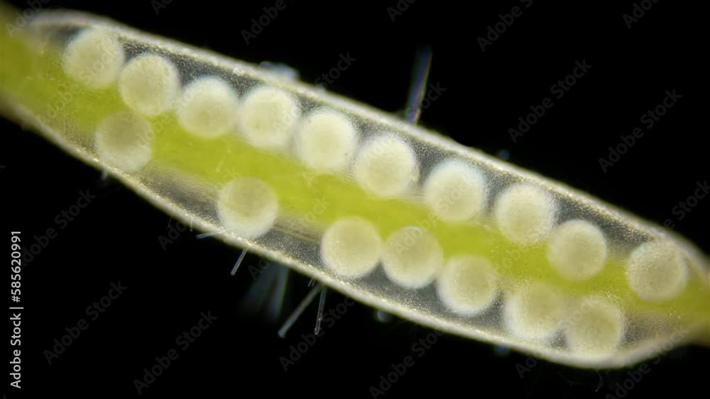 Cocoon with Eggs and Larvae water mites Hydrachnidia under a microscope ...