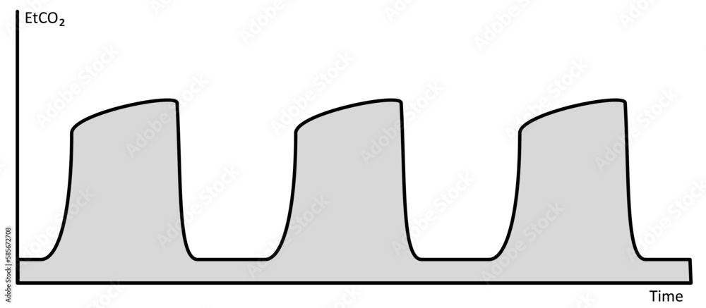 End-Tidal Capnography Waveform Stock Vector | Adobe Stock