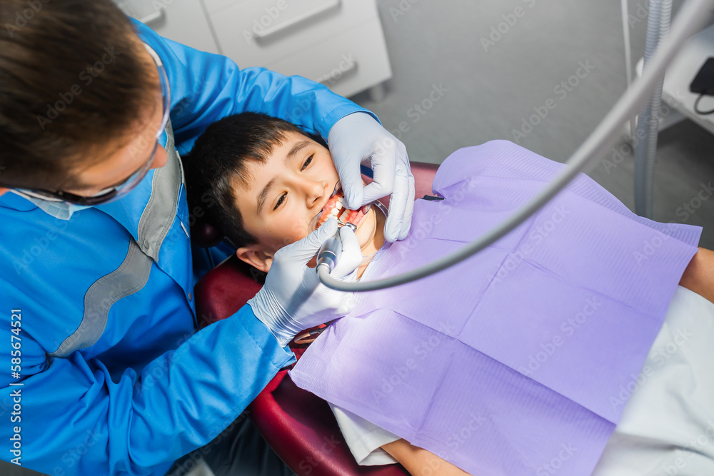 Brushing teeth in a dental clinic. Pediatric dentistry. Dentists brush ...