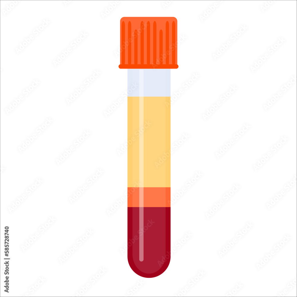 PRP blood test tubes after separation of platelets in the centrifuge ...