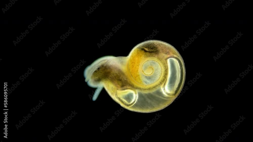 Snail Family Planorbidae under microscope, order Pulmonata. Possibly ...