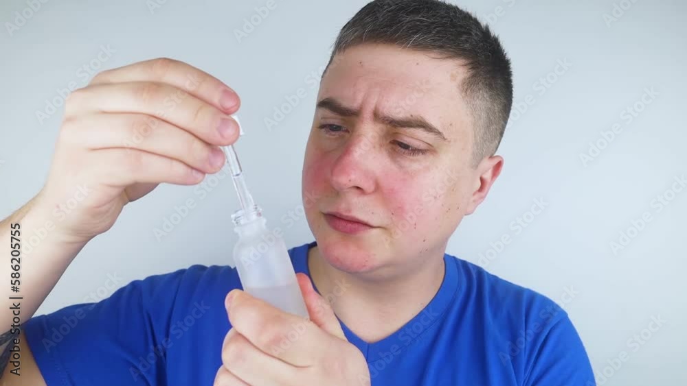 Azelaic acid. Man applies azelainates to her face. Laboratory research ...