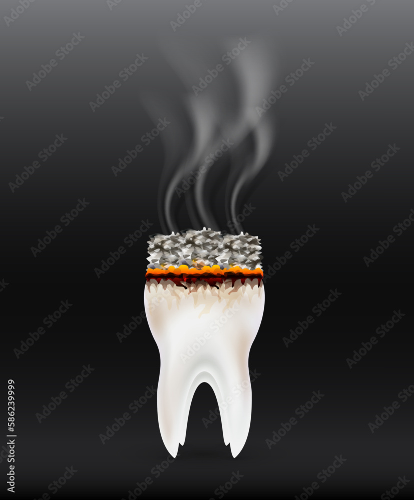 Teeth cigarette. Dangers of smoking effect on human tooth. Dental care ...