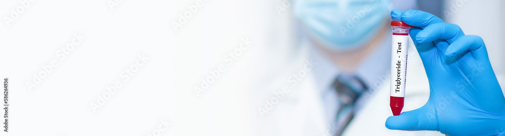 Triglyceride test result with blood sample in test tube on doctor hand ...
