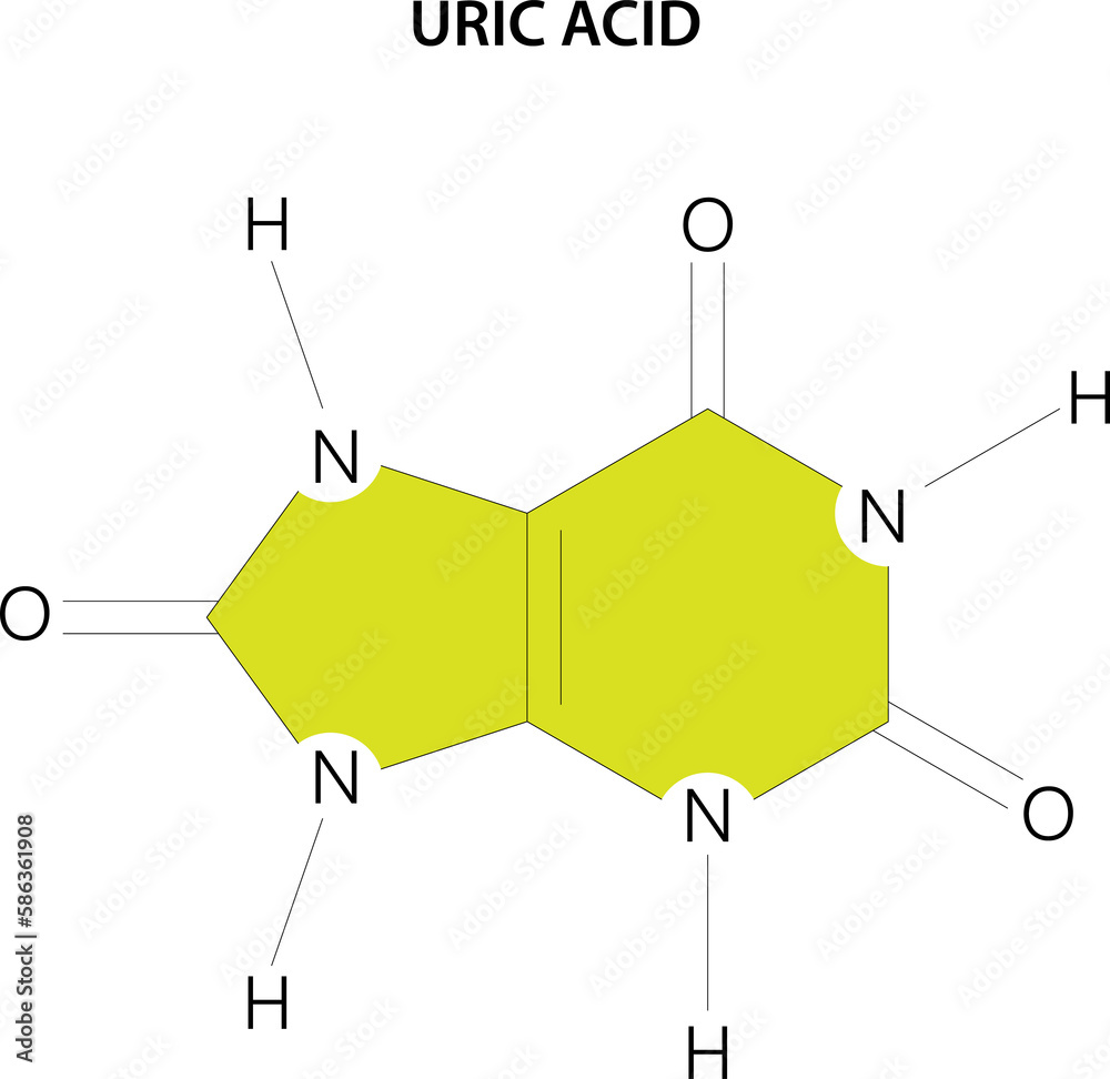 Uric acid is a product of the metabolic breakdown of purine nucleotides ...