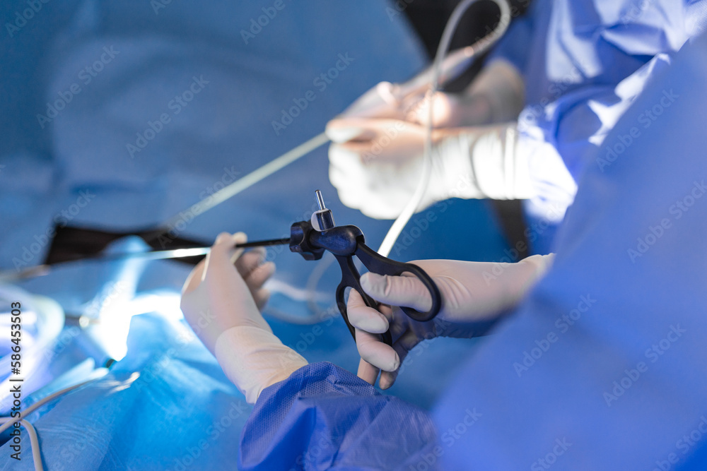 The surgeon's holing the instrument in abdomen of patient. The surgeon ...