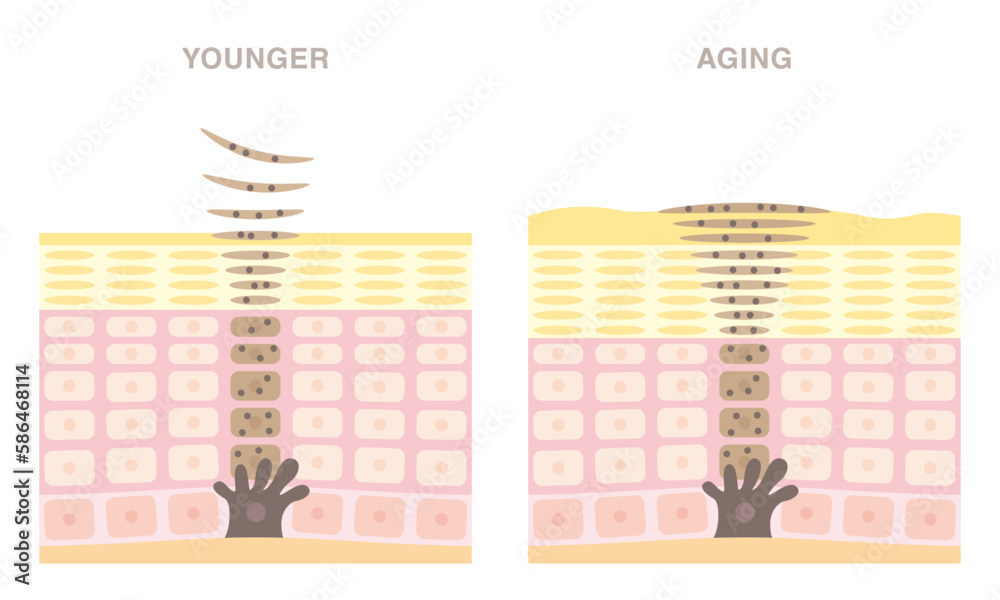 Cross section of skin cell turnover. Skin regeneration of younger and ...