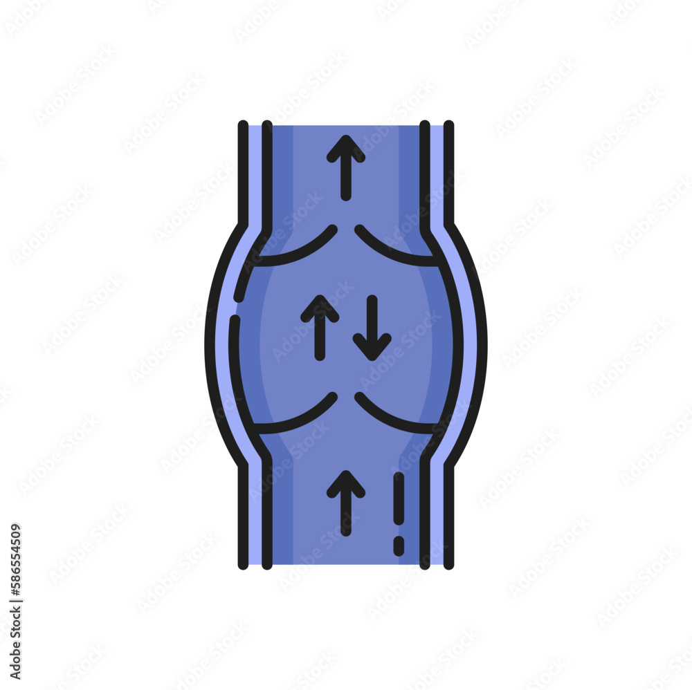 Abnormal blood flow, weak varicose vein not closed valve, isolated ...