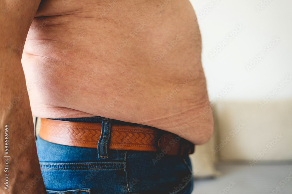 Fat man with a big belly. Fat mature man cellulite belly unhealthy eat ...