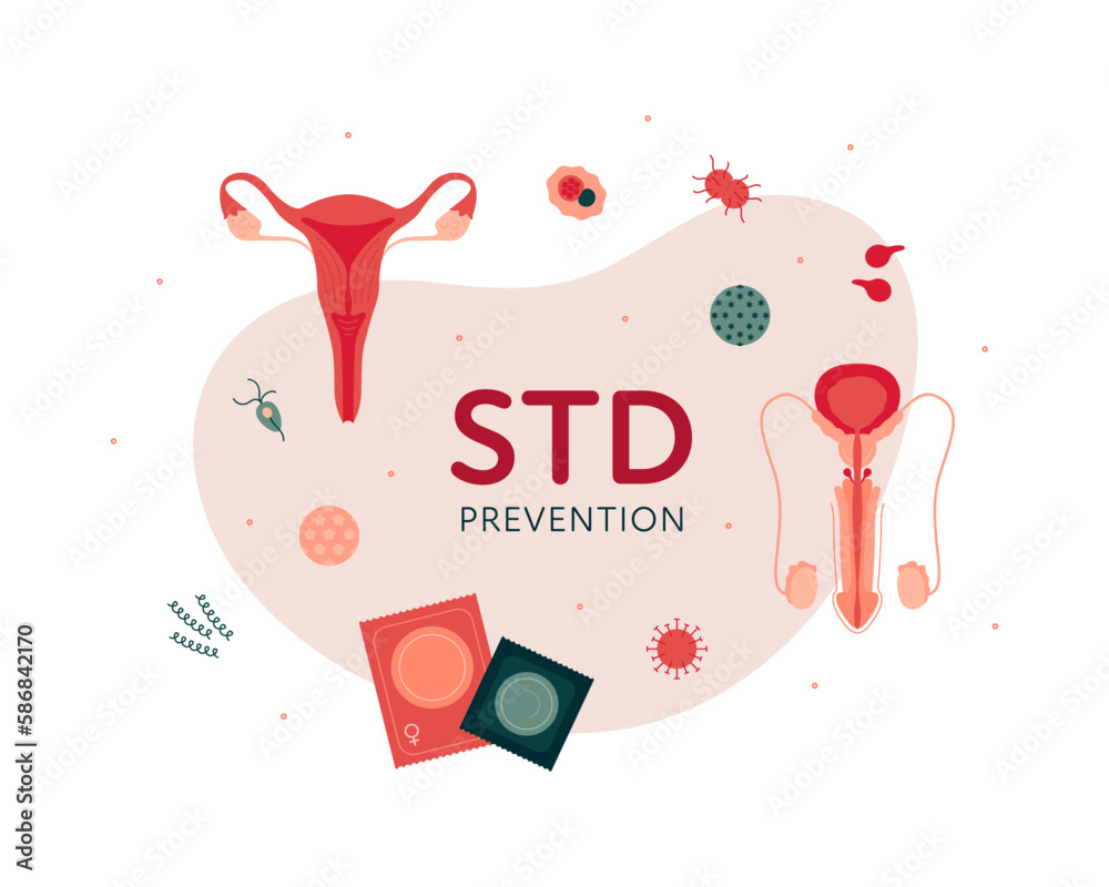 Stockvector Sexual transmitted disease banner template concept. Vector ...