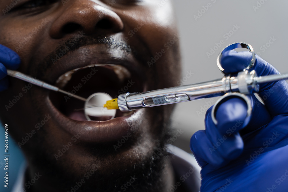 Anesthesia syringe injection close-up. Dentist injects syringe with ...