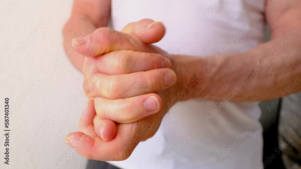 Close up of male hands with dry skin damage, applying moisturizer ...