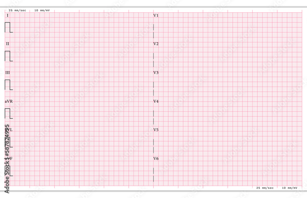 Vetor de Blank ECG Paper 12 Lead, Electrocardiogram Paper Texture ...