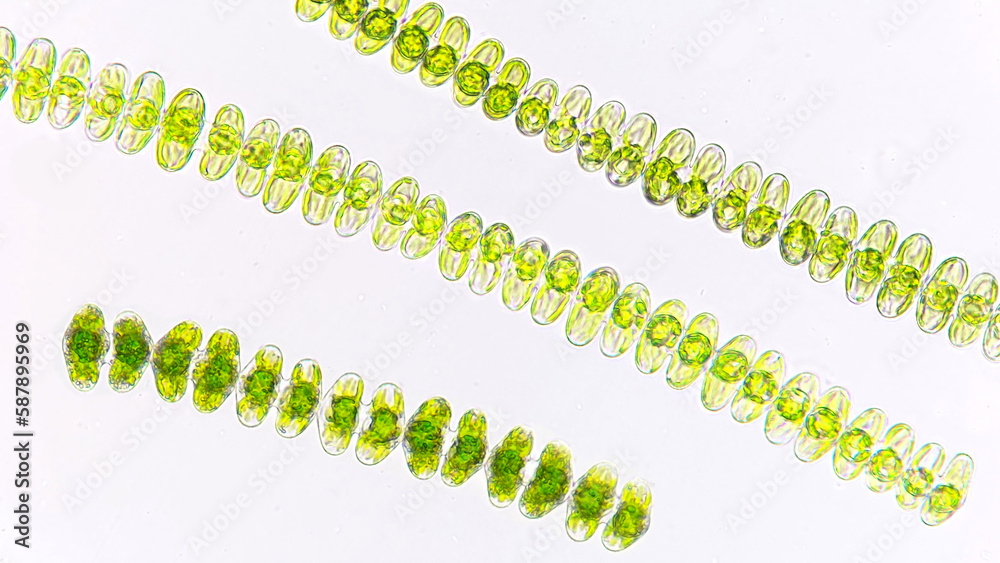 Spondylosium javanicum, a filamentous green algae from desmid group ...