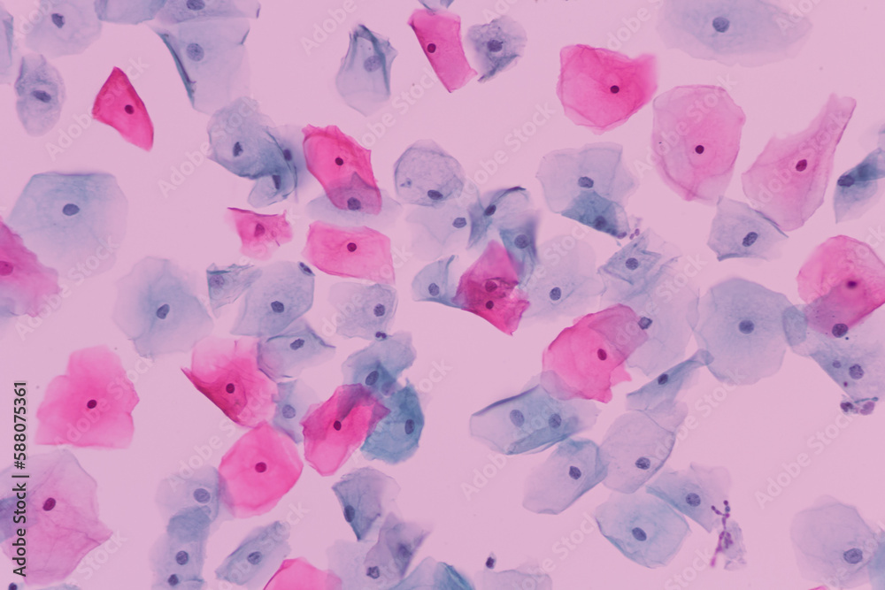 View In Microscopic Of Normal Human Cervix Cells Squamous Epithelial