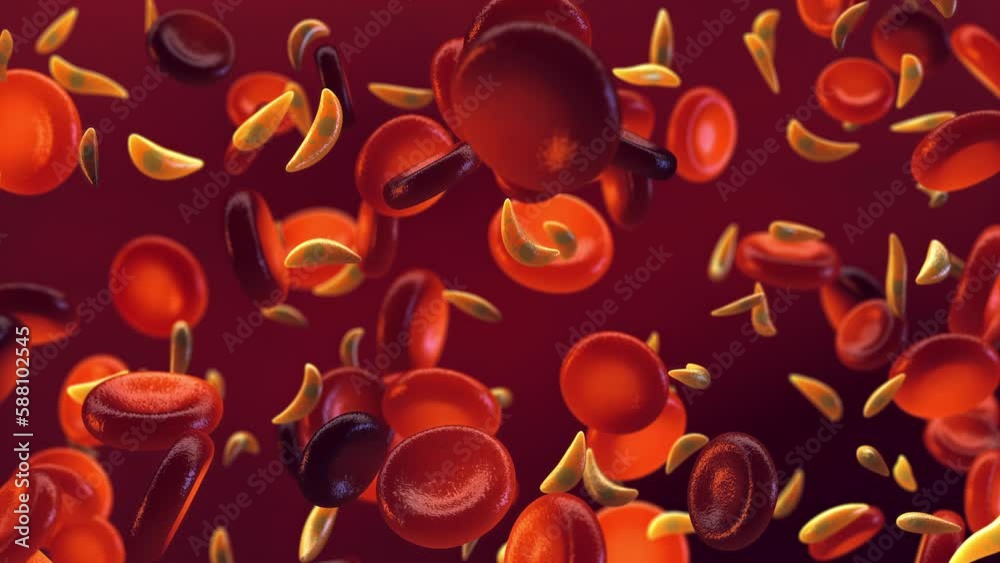 Toxoplasma Gondii tachyzoites in the blood, animation. Toxoplasmosis ...