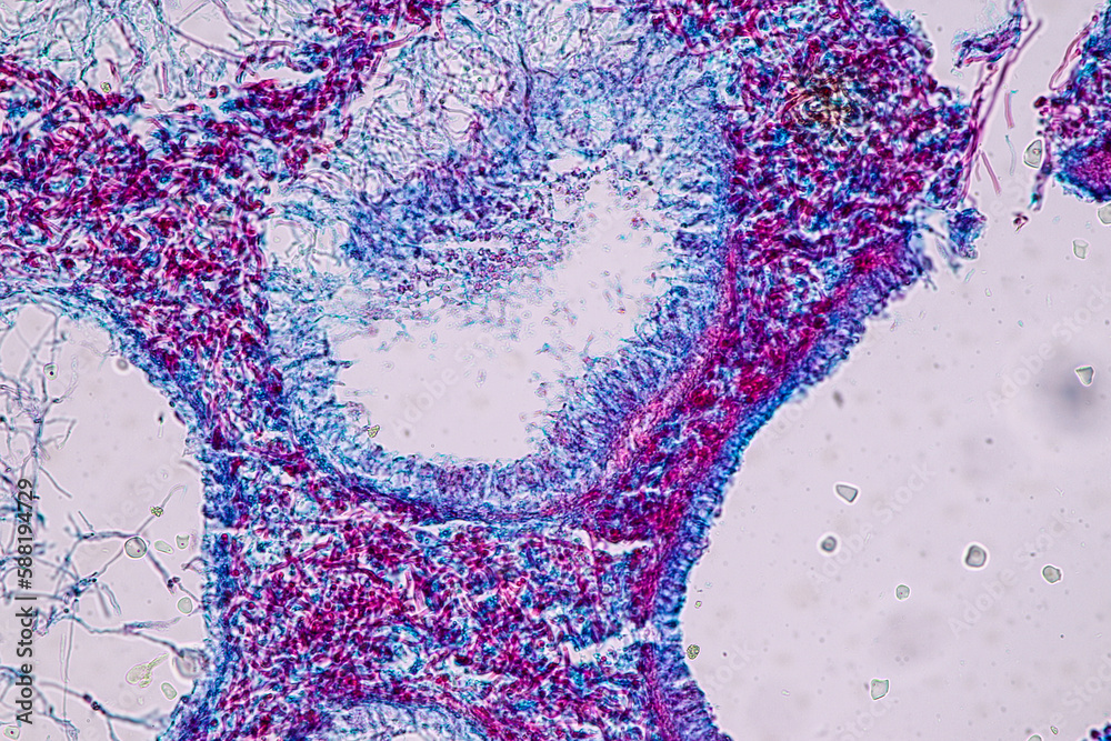 Host cells with spores (mold) are inside wood under the microscope for ...