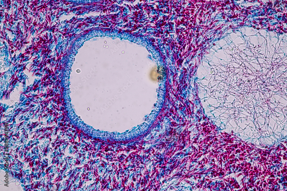 Foto de Host cells with spores (mold) are inside wood under the ...