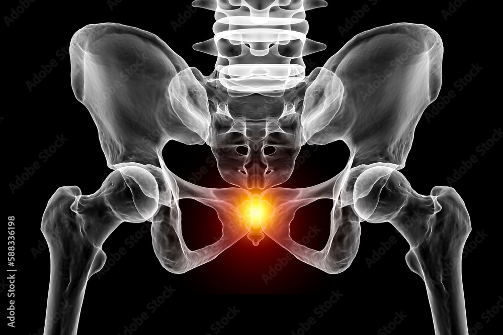 A 3D medical illustration highlighting the coccyx bone marked in red ...