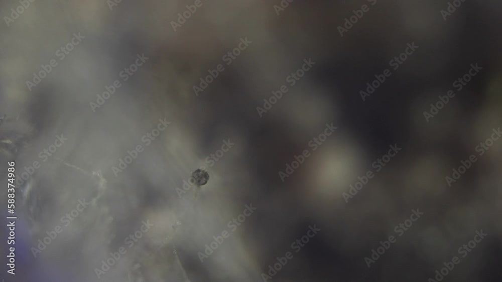 School project in biology. Structure of a white mold fungus under a ...