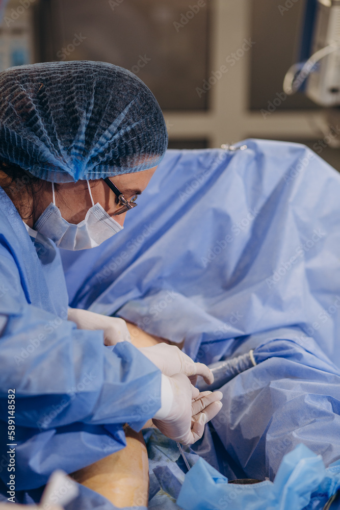 Preparing the patient for phlebectomy surgery. Surgical field marking ...