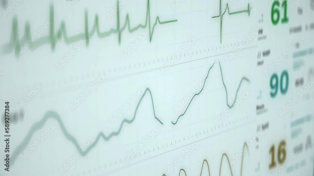 Vidéo Stock Analysing the graph of vital health signs of the emergency ...