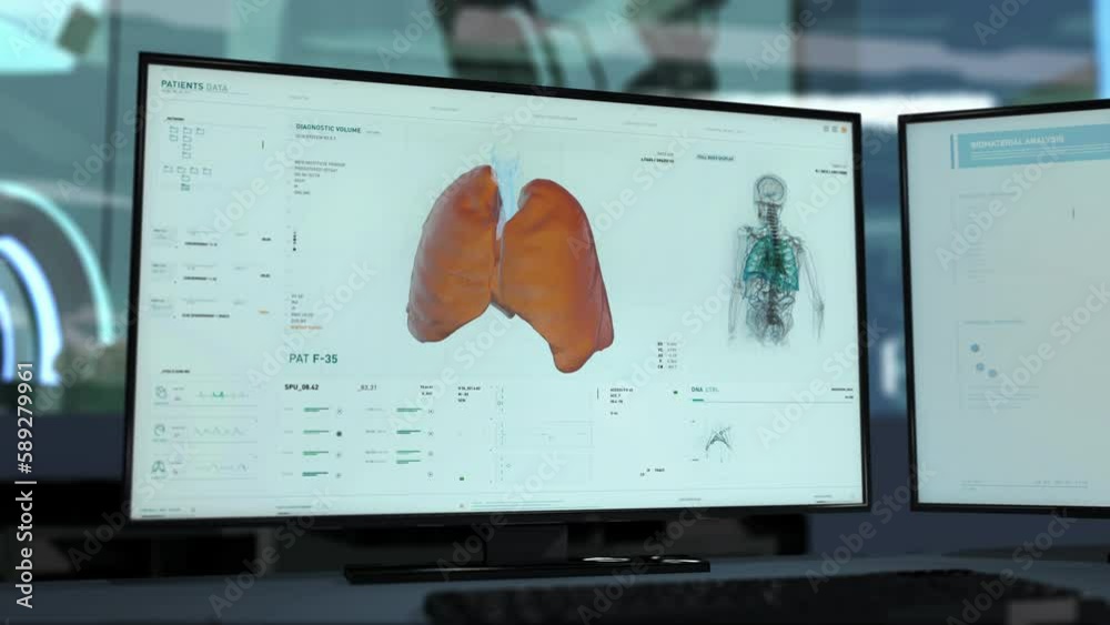 Diagnostic x-ray is scanning the patients chest at the hospital ...