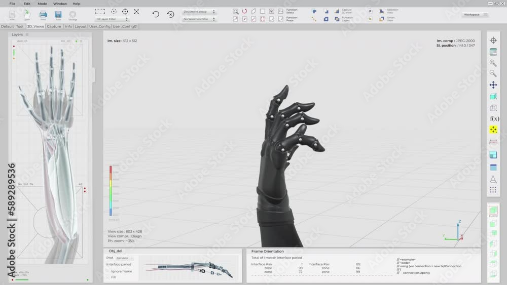 Assembling a futuristic 3D robotic hand for prosthetic surgery ...