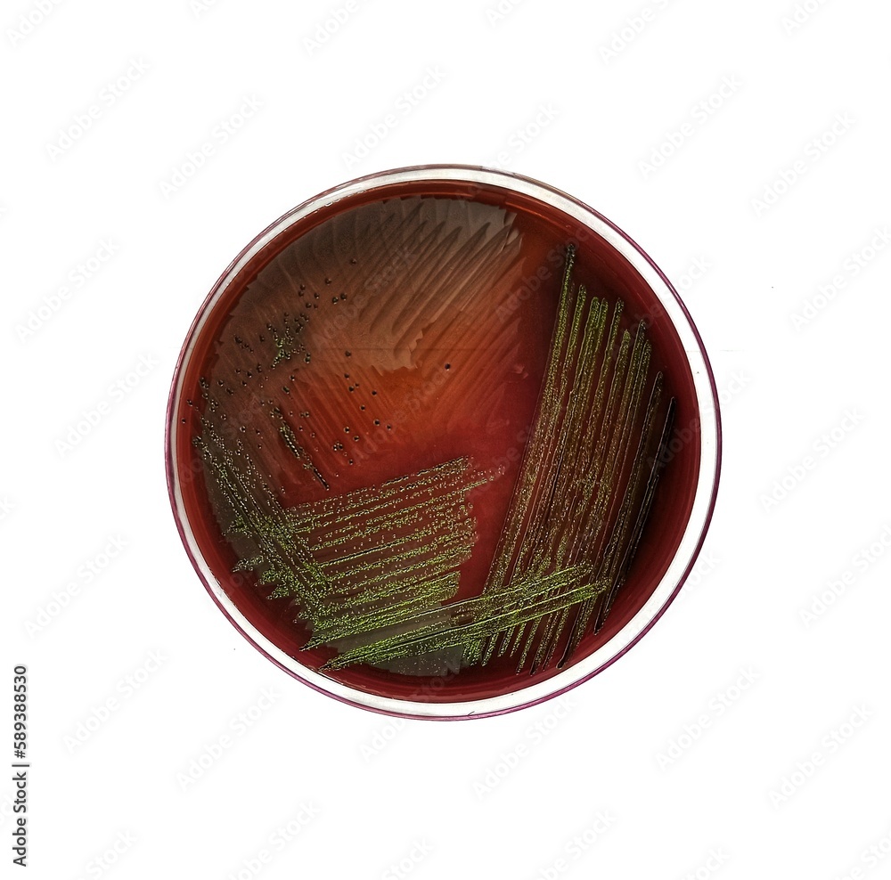 Escherichia coli colonies, metallic green sheen, in EMB agar plate ...