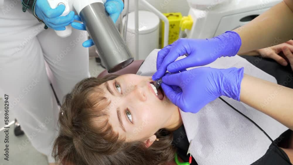 Orthodontist scans patient with dental intraoral scanner ...