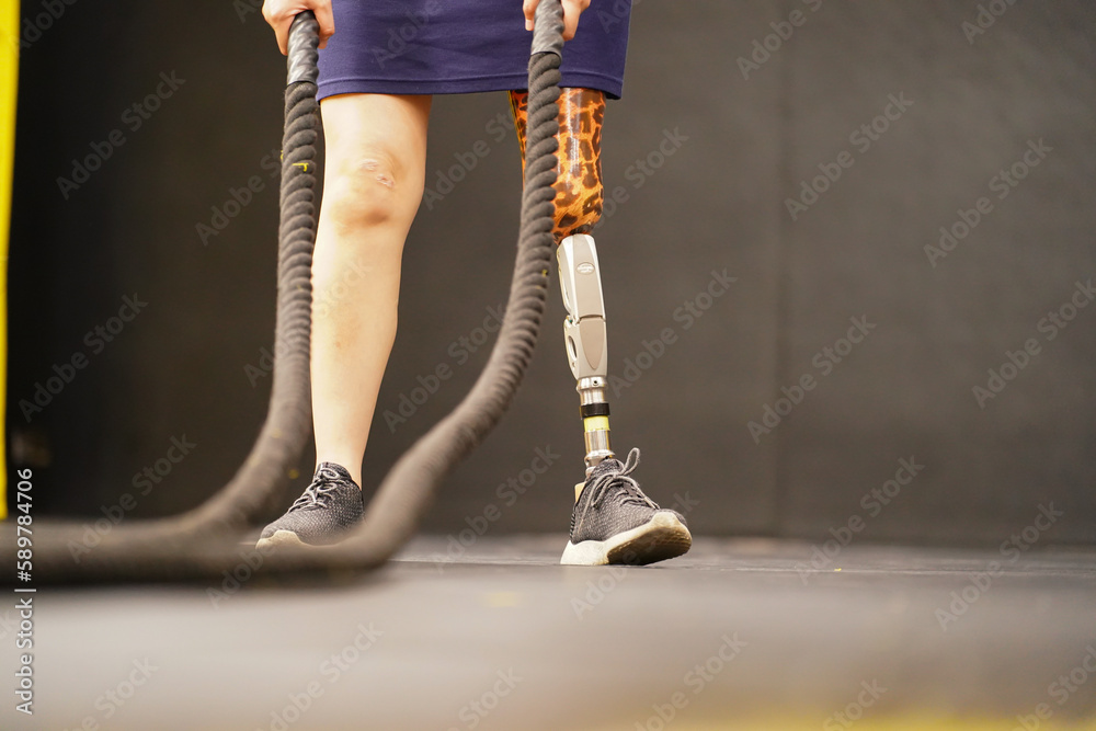 Young female with one prosthetic leg with doing arm and shoulder ...