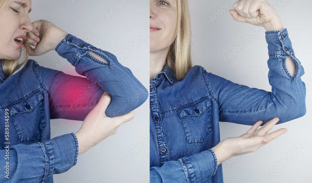 Before and after. In left woman suffers from pain in her shoulder ...